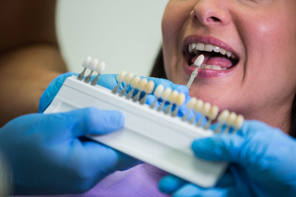 Corona dental: ¿qué es y cuándo se necesita?